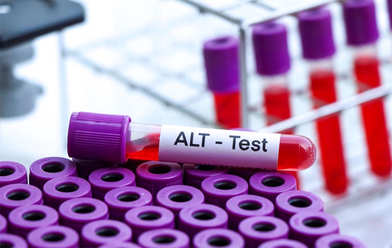 Chỉ số ALT 70 UI/L có phải bị bệnh về gan không? - Thuốc Dân Tộc
