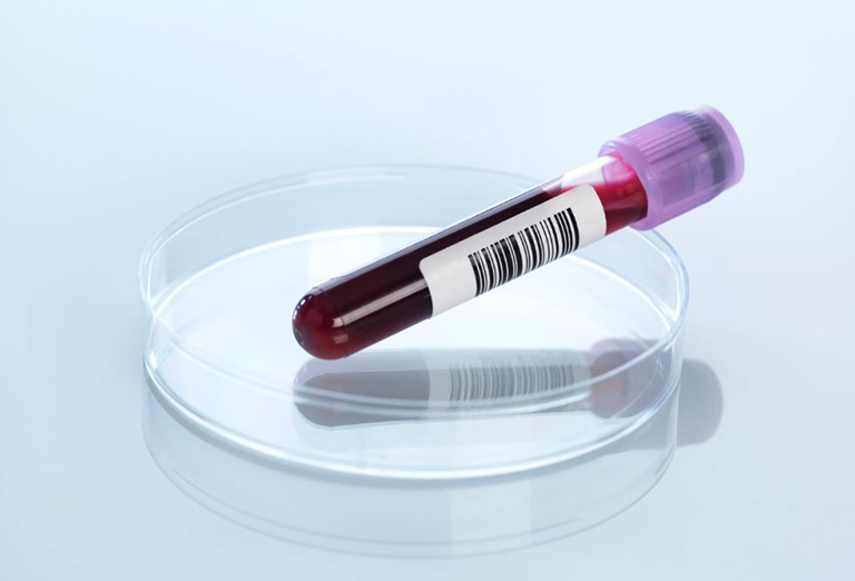 Chỉ số ALT 45 UI/L là thấp hay cao? - Thuốc Dân Tộc