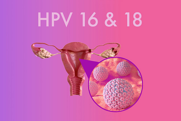 Vợ bị nhiễm HPV 16 chồng có phải đi xét nghiệm không? - Thuốc Dân Tộc